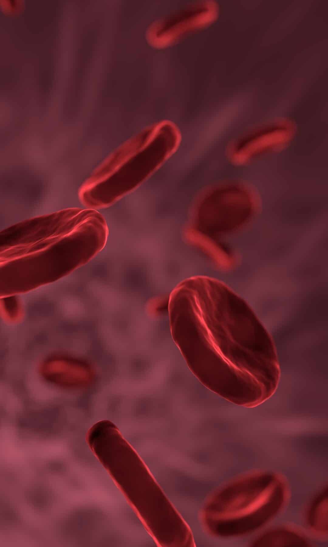 Iron Deficiency Anemia? Boost Your Iron Levels Naturally