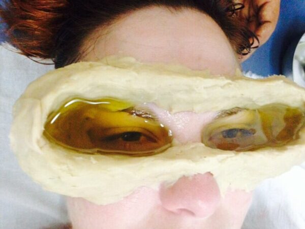 Netra Tarpana: A Unique and Effective Eye Treatment - Vital Veda